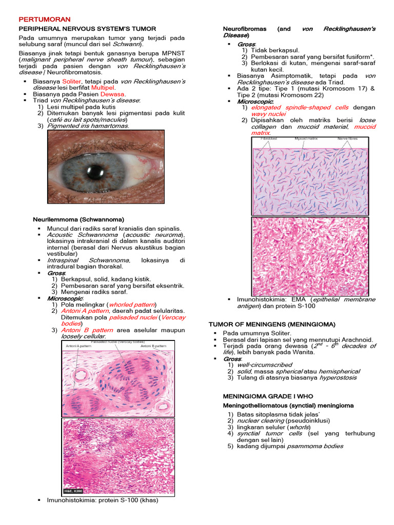 Tumor Sistem Saraf Perifer dan Pusat | PDF