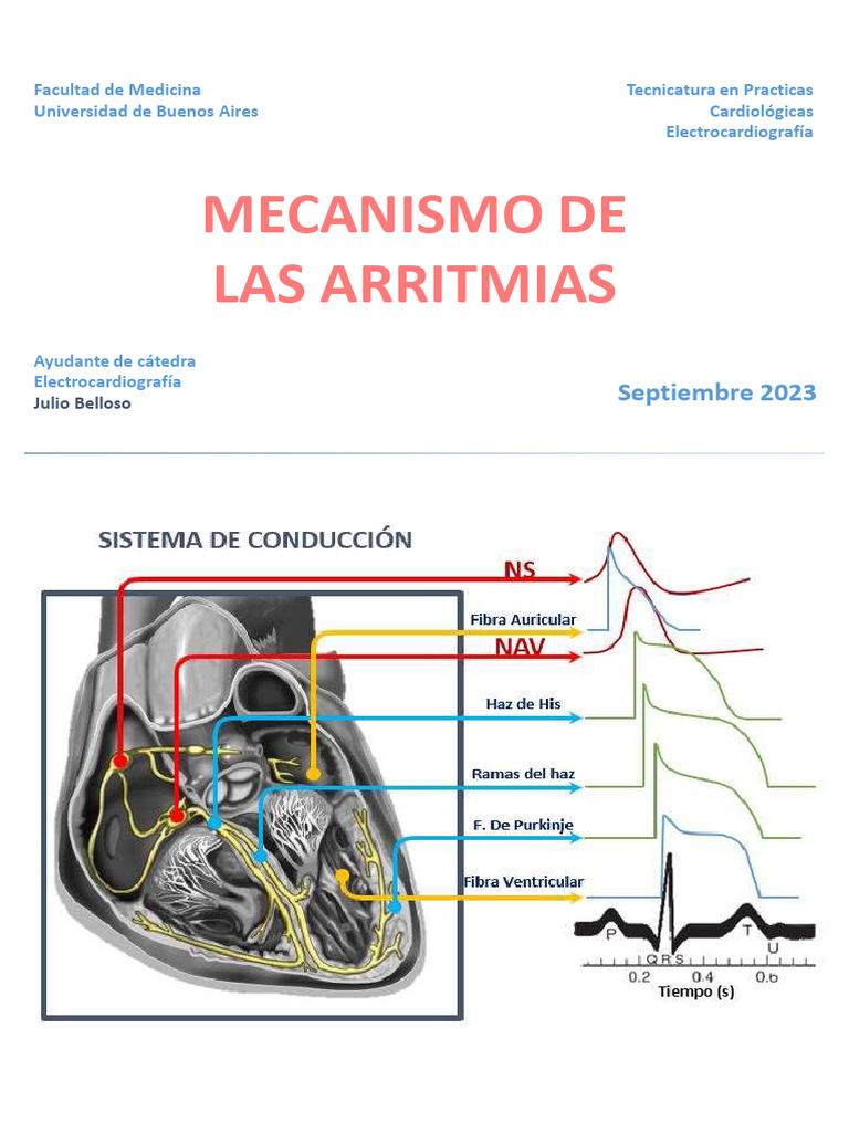 Mecanismos de Arritmias Cardíacas | PDF | Potencial de acción | Canal ...