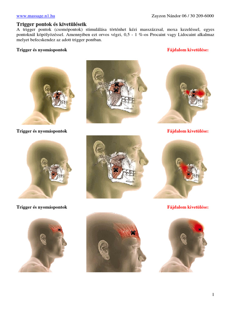 TRIGGER Pontok | PDF