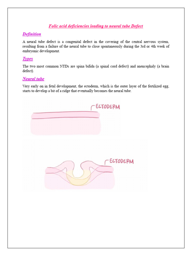 Folic Acid Deficiencies Leading To Neural Tube Defect | PDF