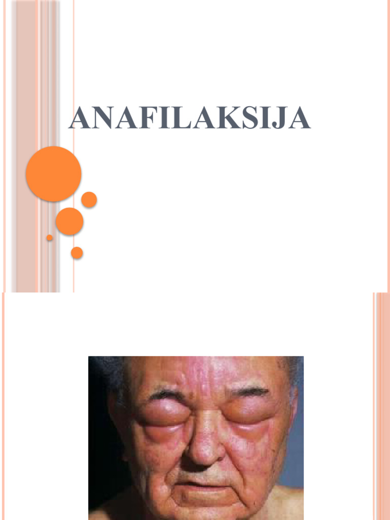 ANAFILAKTIČKI | PDF