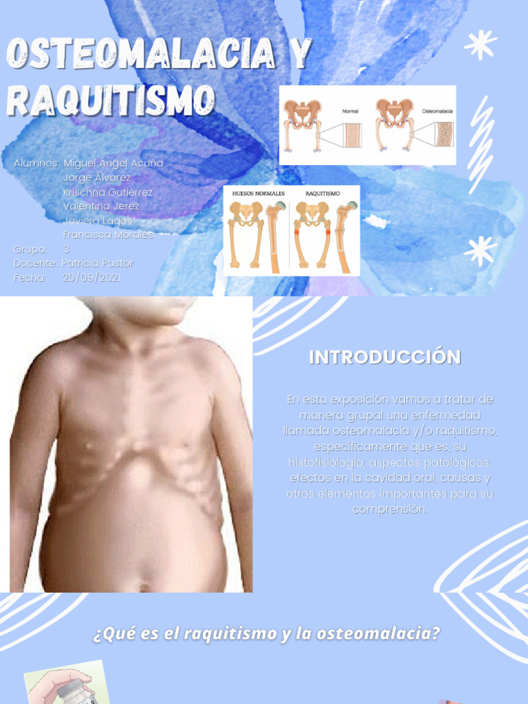 Osteomalacia y Raquitismo | PDF