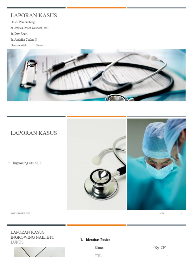 Laporan Kasus SLE | PDF