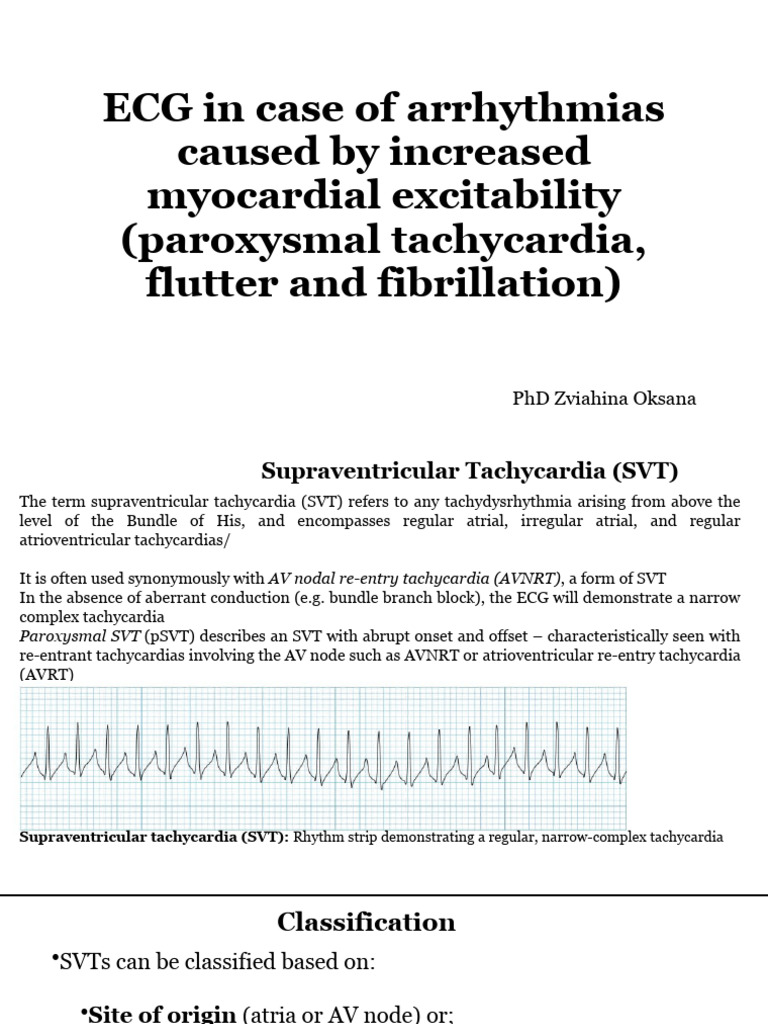 Paroxysmal Tachycardia, Flutter and Fibrillation | PDF