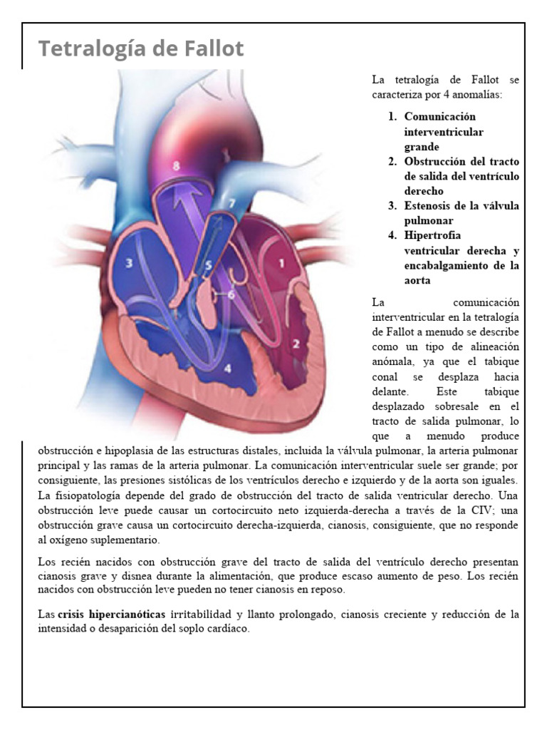 Tetralogía de Fallot | PDF | Corazón | Ventrículo (corazón)