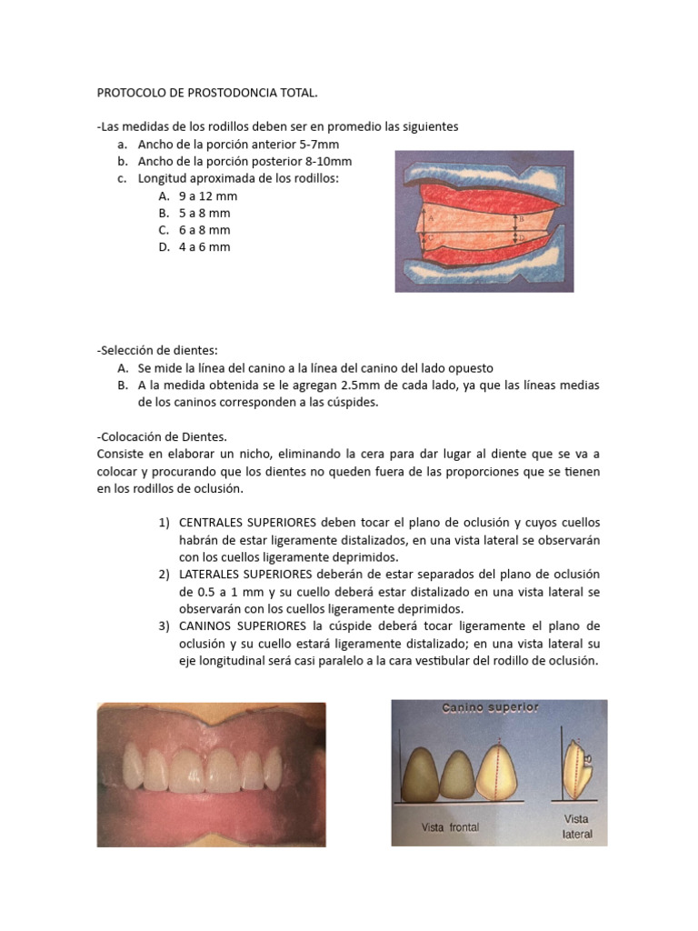 Protocolo de Prostodoncia Total | PDF