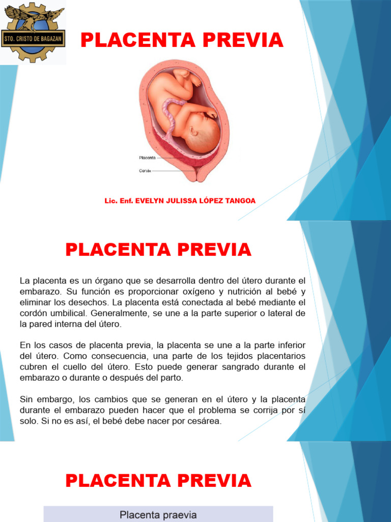 Placenta Previa: Tipos y Complicaciones | PDF | Ciencia y matemáticas ...