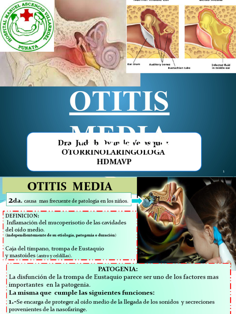 Otitis Media: Diagnóstico y Tratamiento | PDF | Oído | Epidemiología