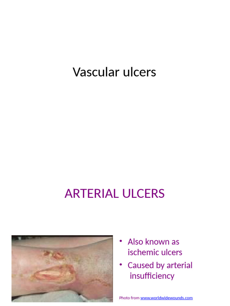 IPT Lec#7 Vascular-Uclers | PDF