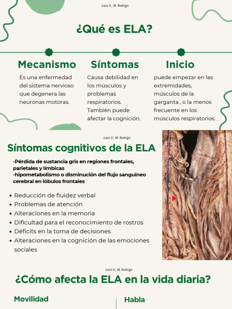 La Esclerosis Lateral Amiotrófica (ELA) | PDF