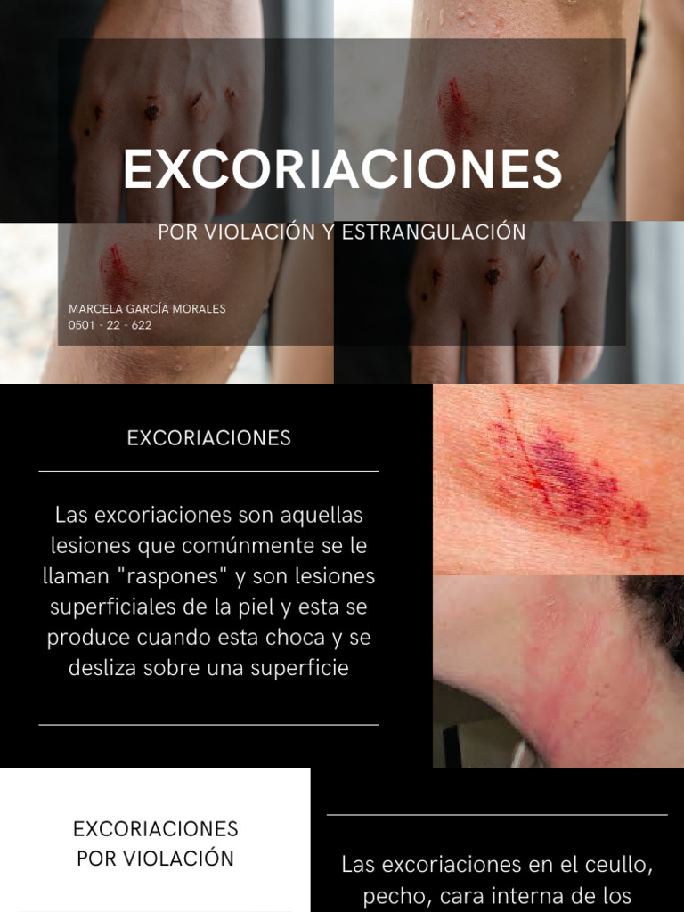EXCORIACIONES | PDF