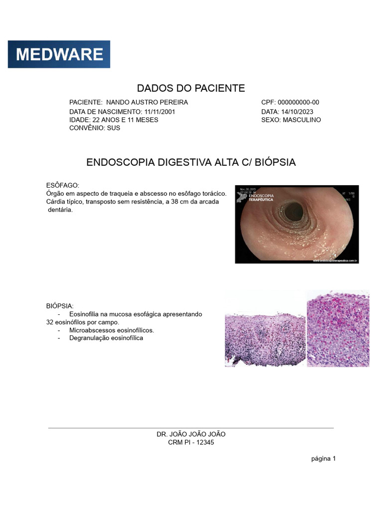 Laudo endoscopia | PDF