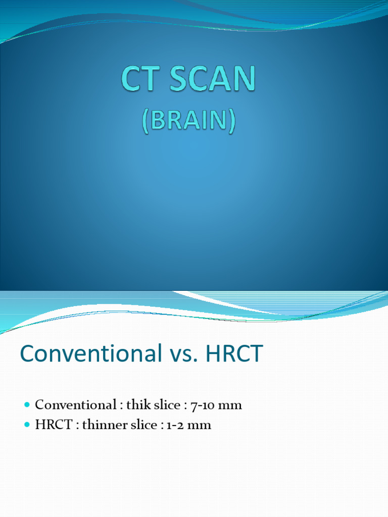 CT all that you need to know | PDF