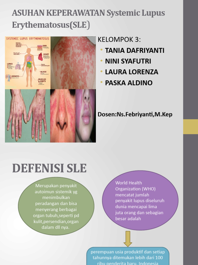 Kelompok 3 - Askep Sle. | PDF