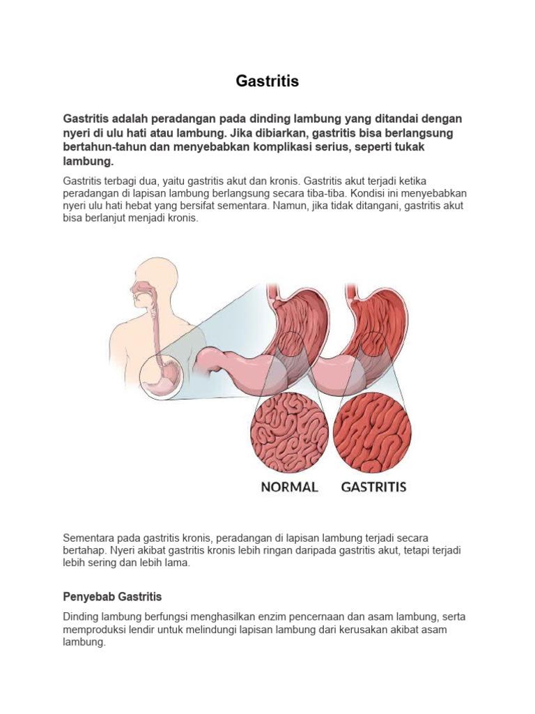 Penyakit Gastritis | PDF