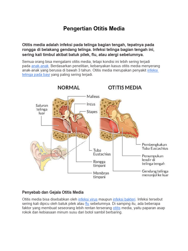 Penyakit Otitis Media | PDF
