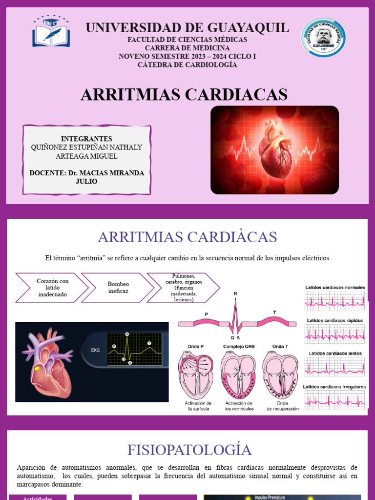Presentación de Arritmias Cardiacas | PDF