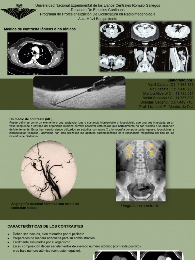 Diapositivas Sobre Medios de Contraste | PDF