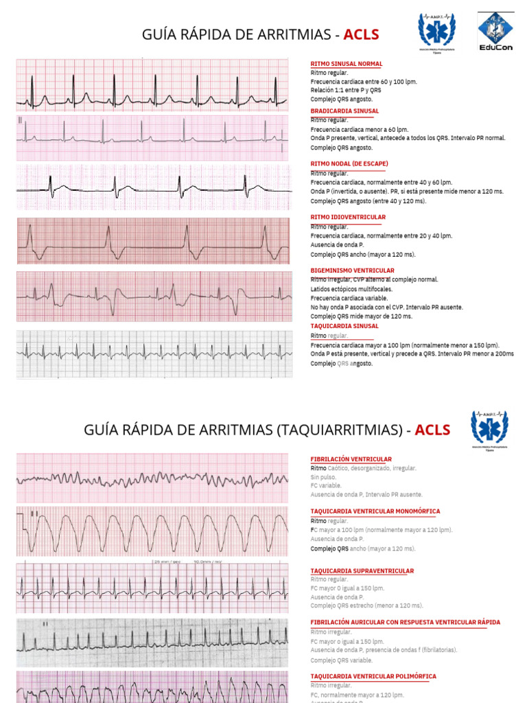 Guía Rápida de Arritmias - Acls PDF | PDF
