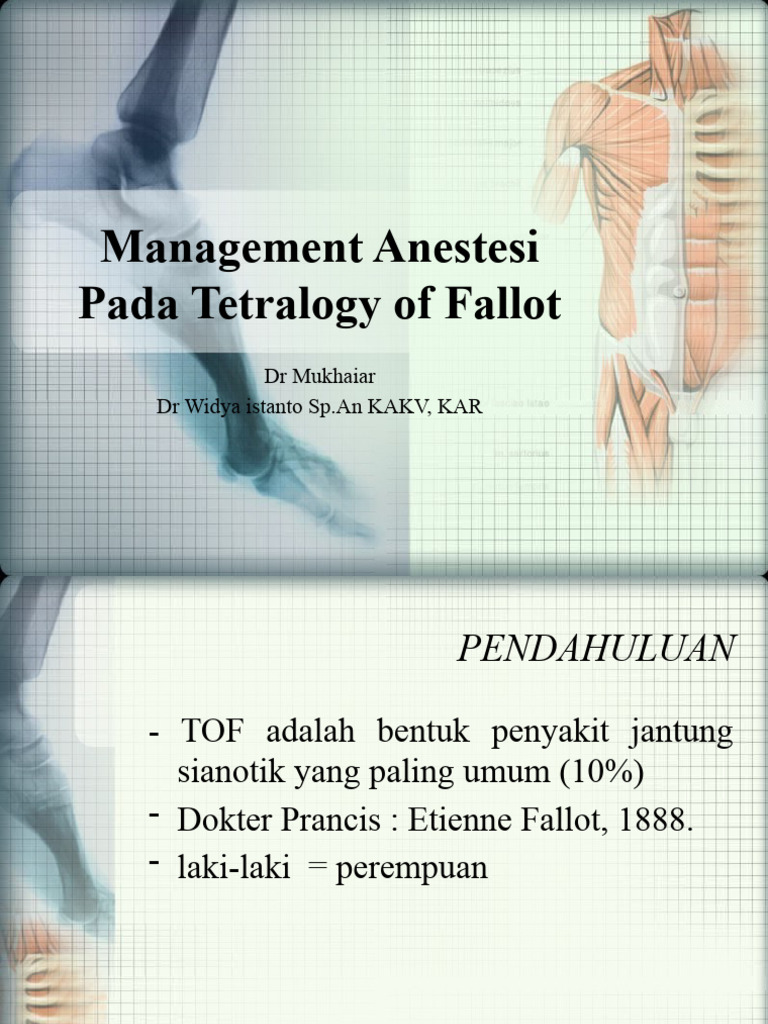 Management Anestesi Pada Tetralogy of Fallot | PDF