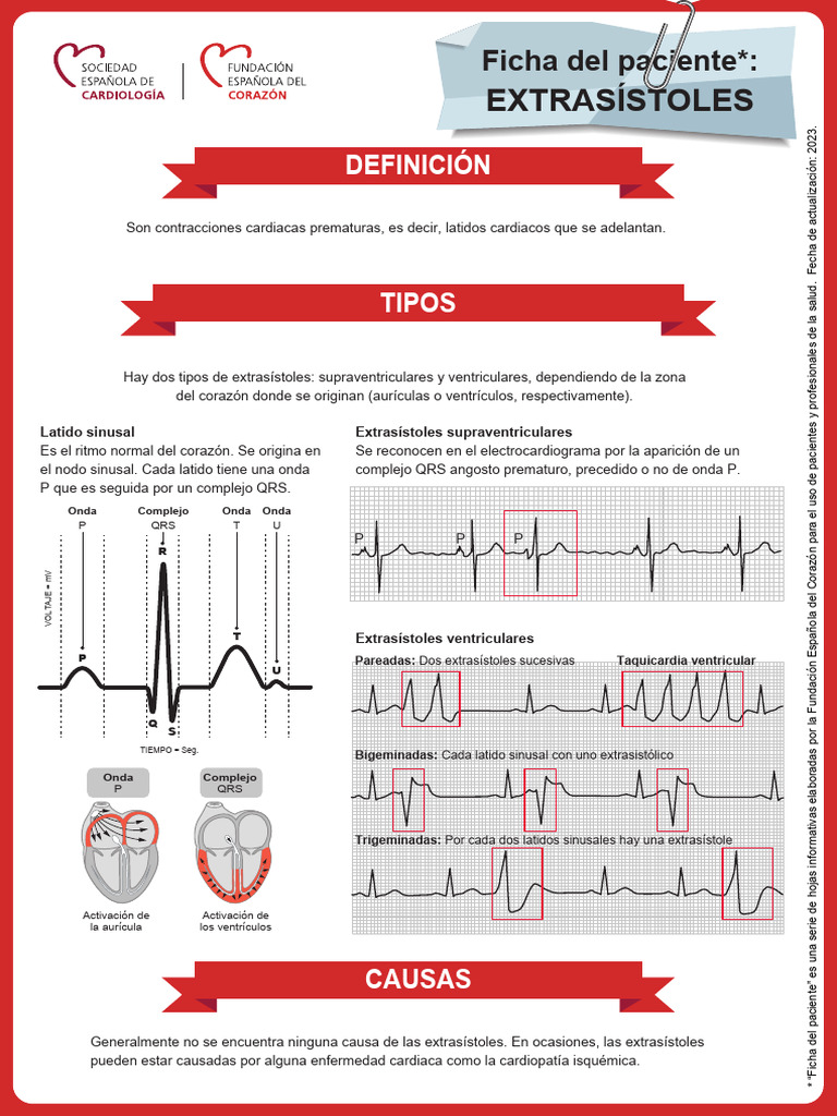 Ficha Extrasistoles | PDF