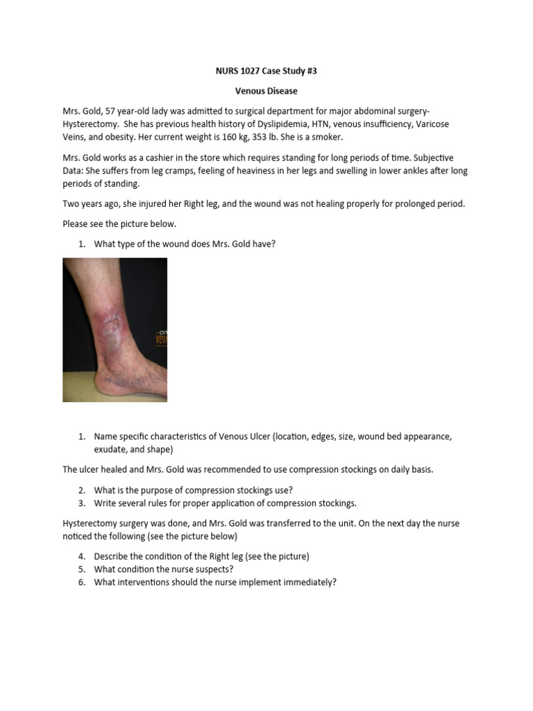 DVT Case Study | PDF