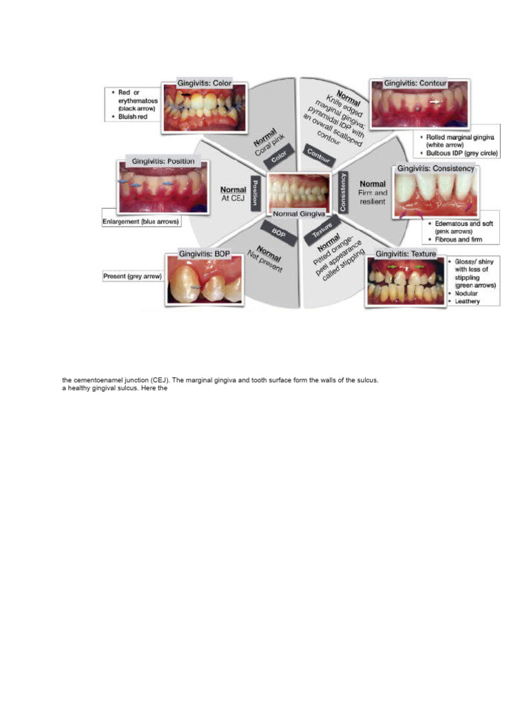 The Cementoenamel Junction | PDF