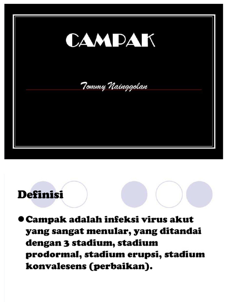 PDF Presentasi Campak PPT - Compress | PDF