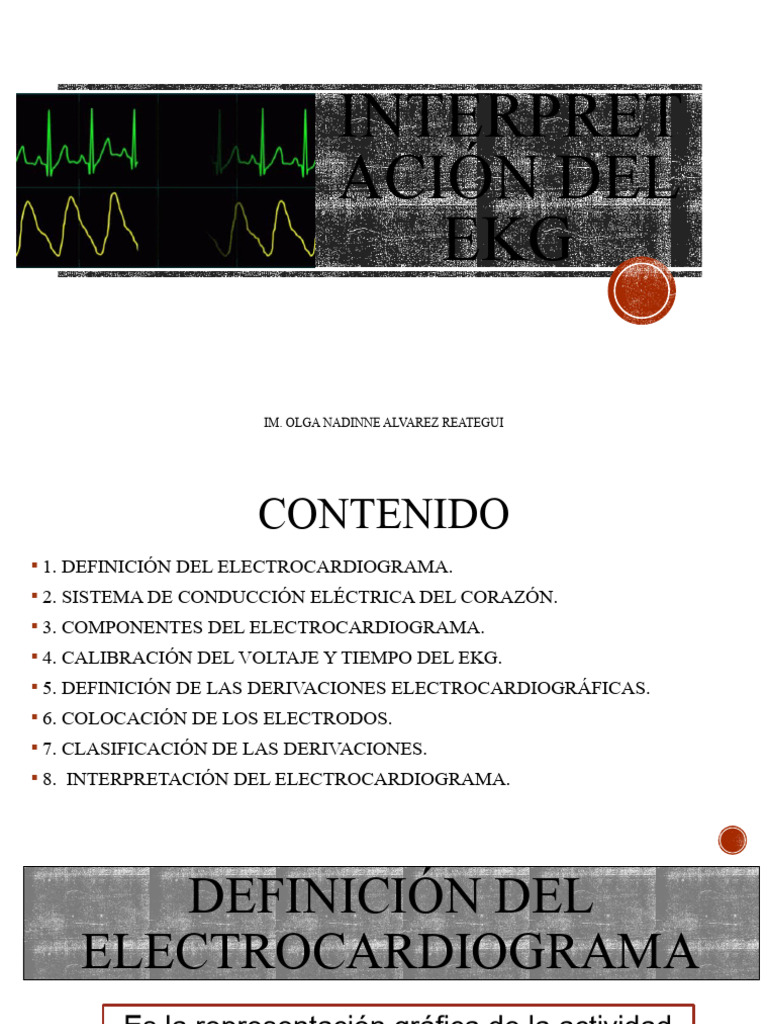 Interpretación Del Ekg | Descargar gratis PDF | Electrocardiografia ...