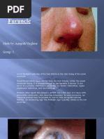 Trotter's Method for Managing Epistaxis | PDF | Clinical Medicine ...