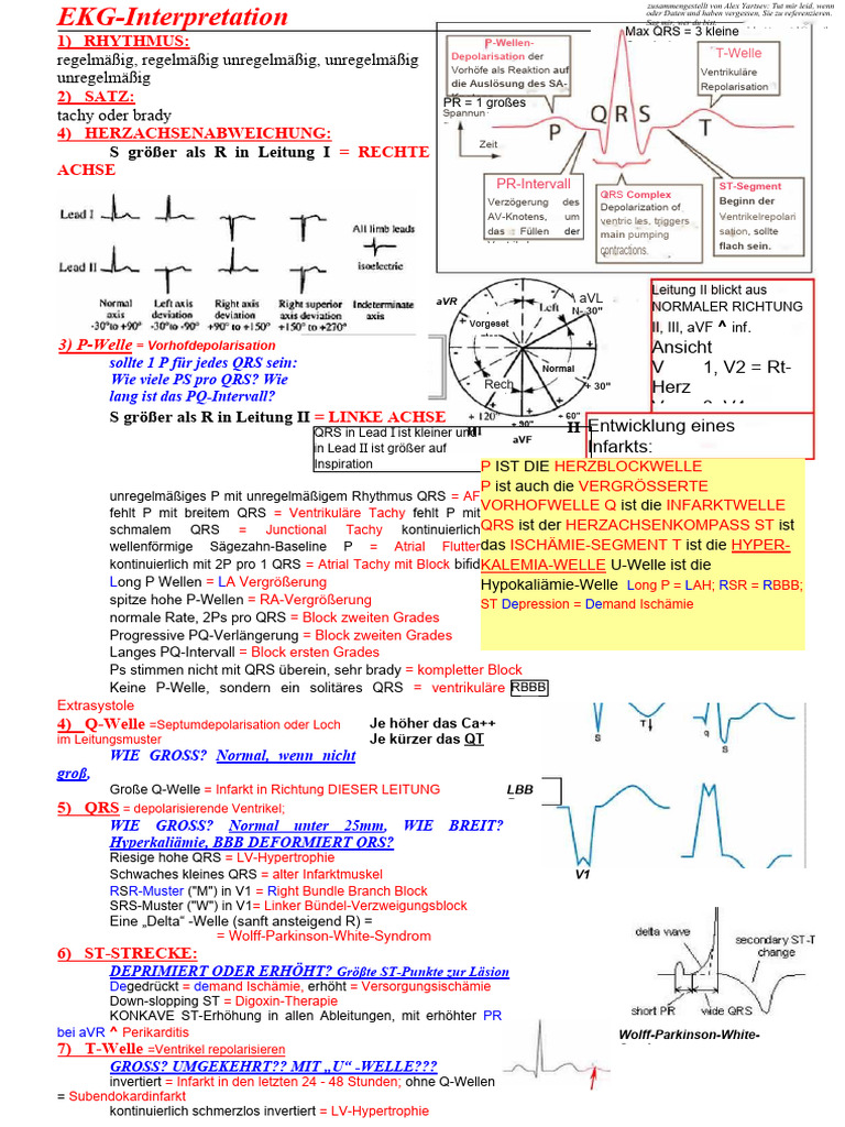 Spickzettel Zur EKG-Interpretation | PDF