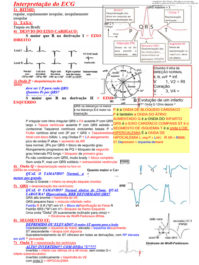 Interpretação de ECG: Análise e Diagnósticos | PDF