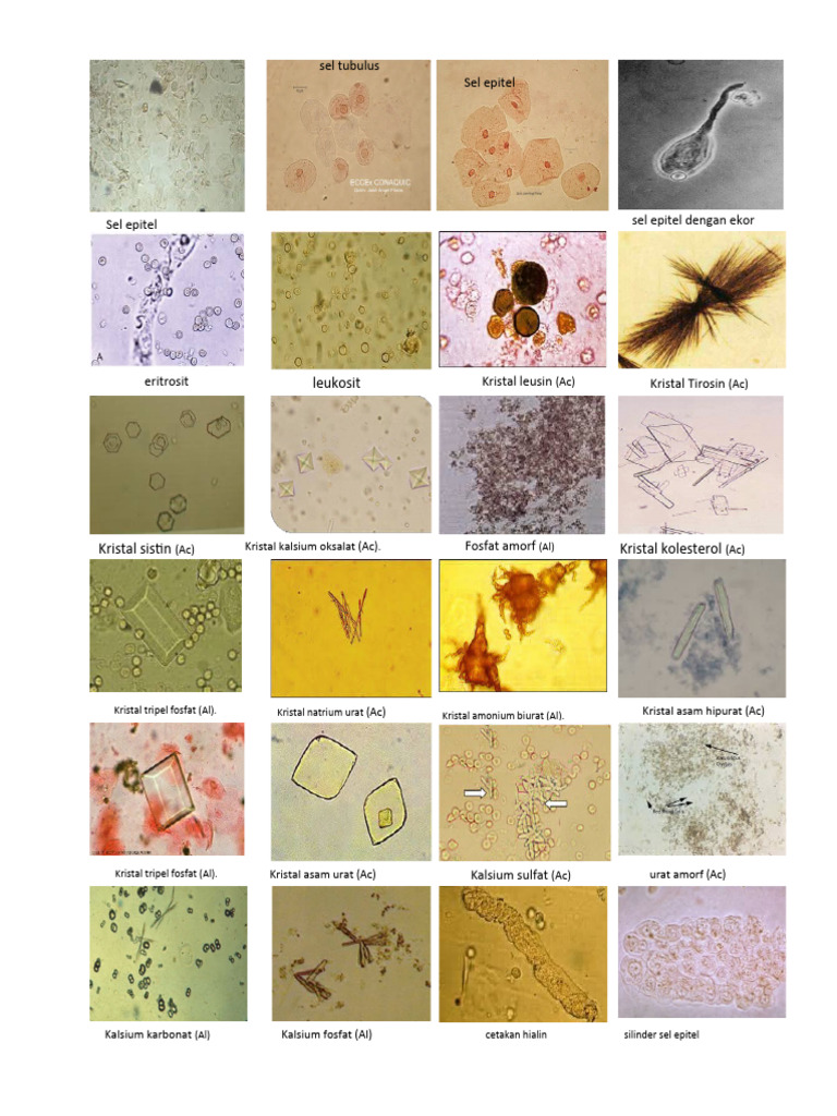 Atlas Urin | Descargar gratis PDF | Medicina CLINICA | Orina