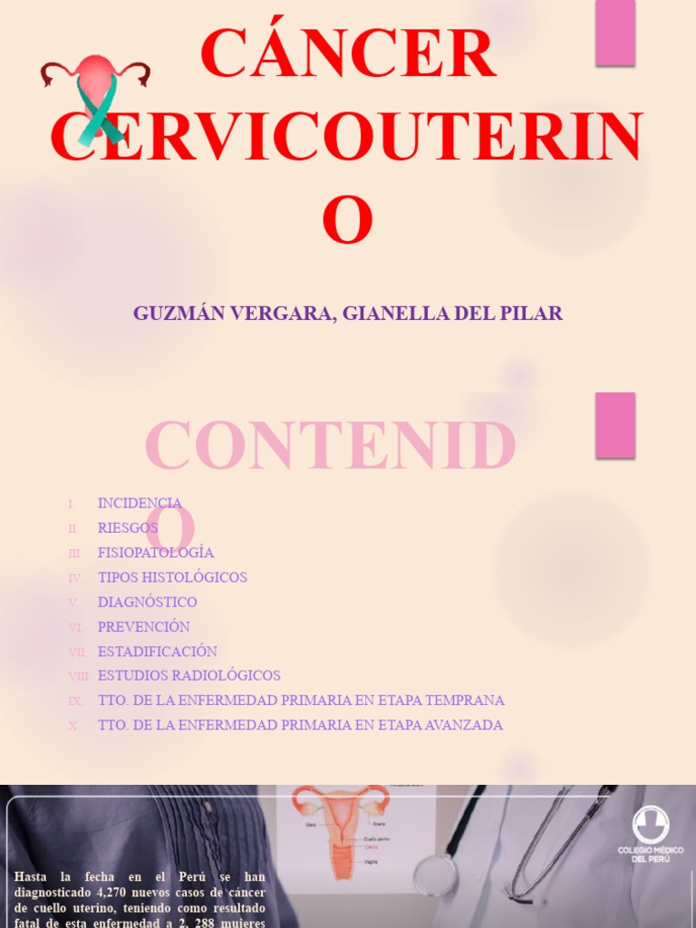 Cáncer Cervicouterino | Descargar gratis PDF | Cáncer de cuello uterino | Adenocarcinoma