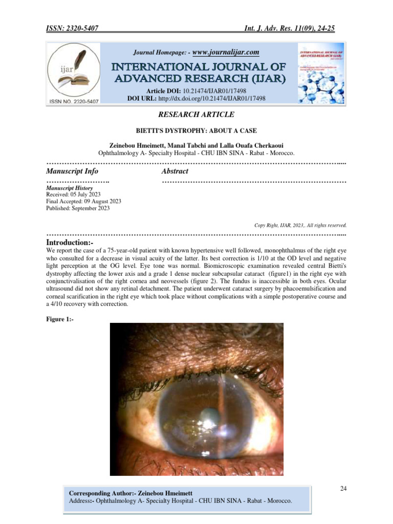 Bietti's Dystrophy Case Study Report | PDF