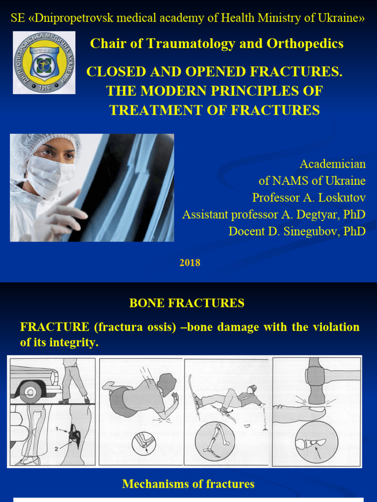 Open and Closed Fractures - 2018 English | Download Free PDF | Bone ...