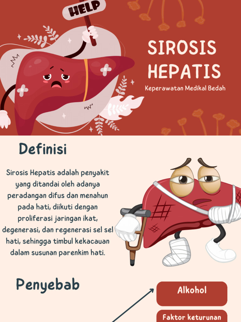 Sirosis Hepatis - 20231009 - 230020 - 0000 | PDF