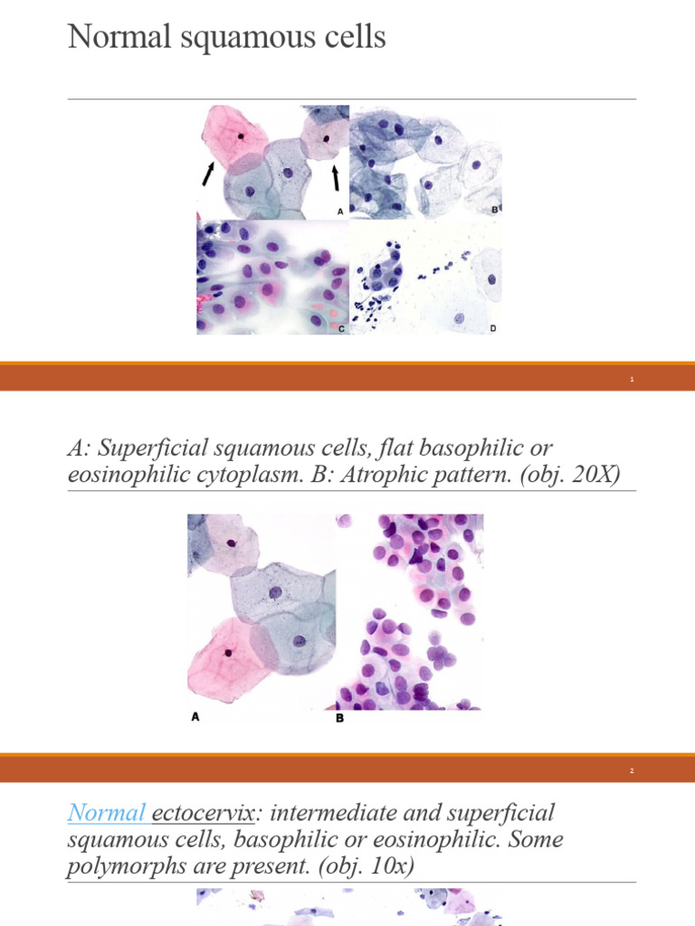 Normal Ectocervical Squamous Cells Analysis | PDF | Epithelium | Anatomy