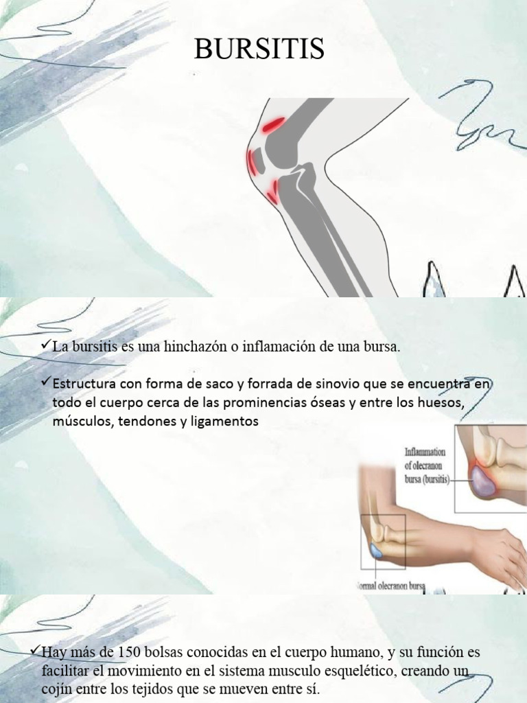 Bursitis | PDF | Rodilla | Especialidades Medicas