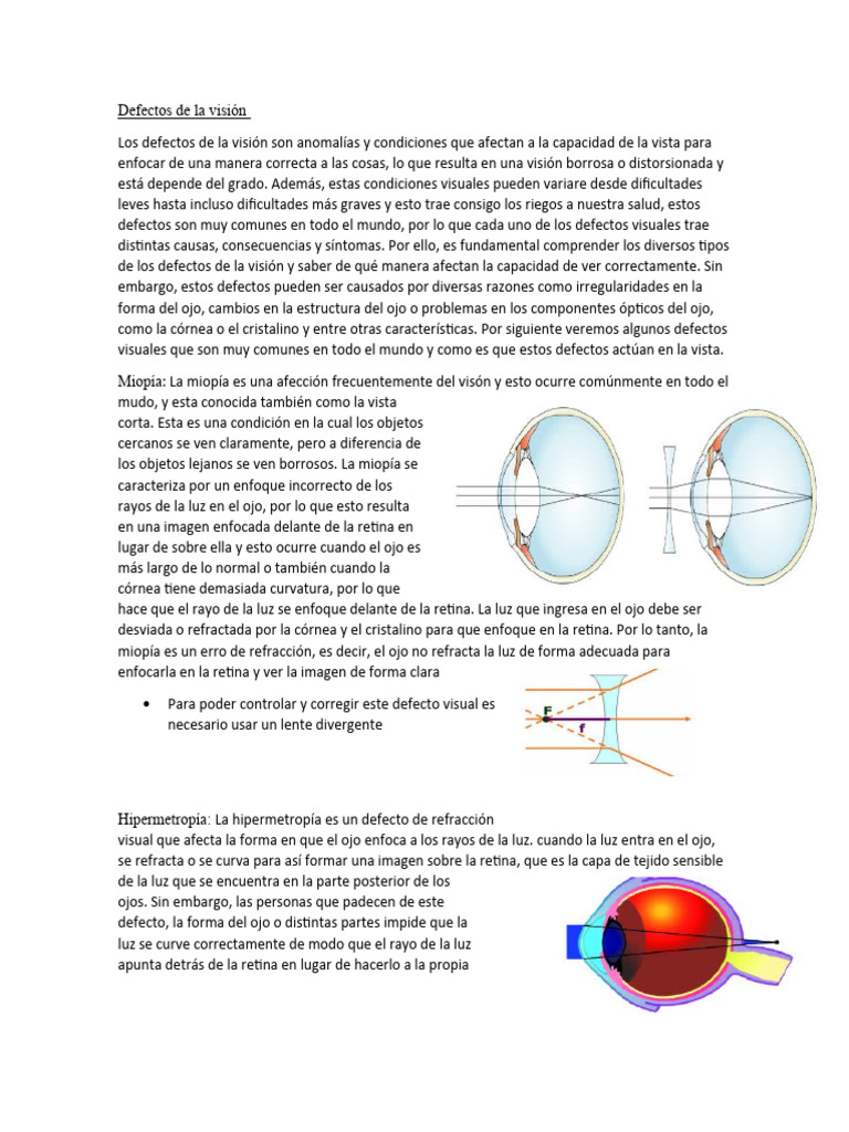 Defectos de La Visión Infore Biofisica 13 | PDF | Ojo humano ...
