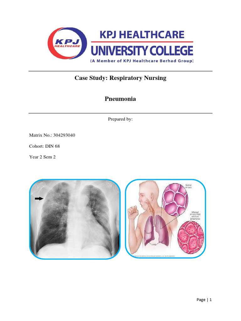 Pneumonia Case Study 1 | PDF | Respiratory Tract | Human Nose