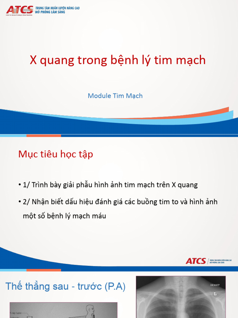 XQuangTrongBenhLyTimMach Y2 | PDF