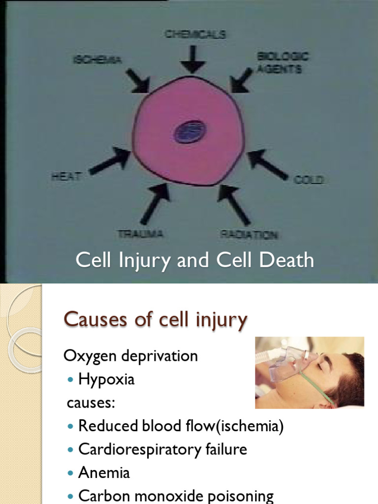 2 Cell Injury and Cell Death | PDF | Necrosis | Apoptosis