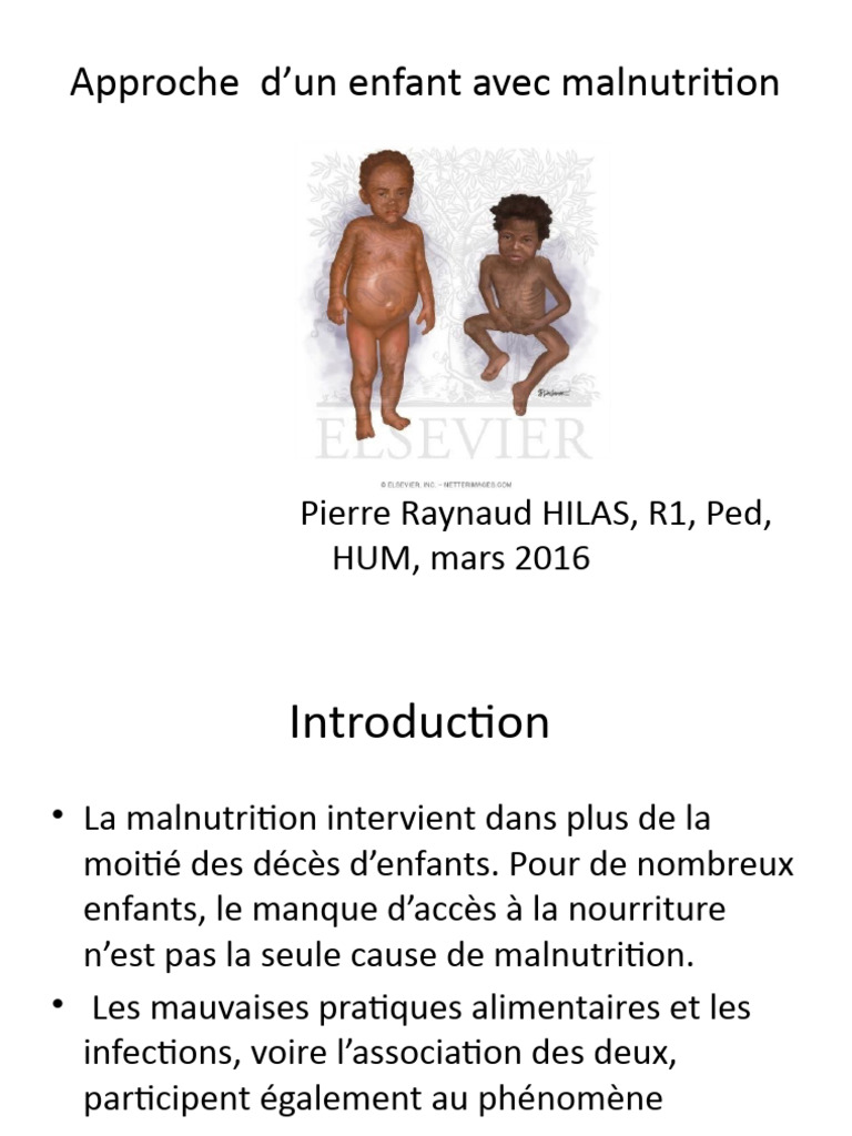 Approche D'un Enfant Avec Malnutrition | PDF | Malnutrition | Hypoglycémie