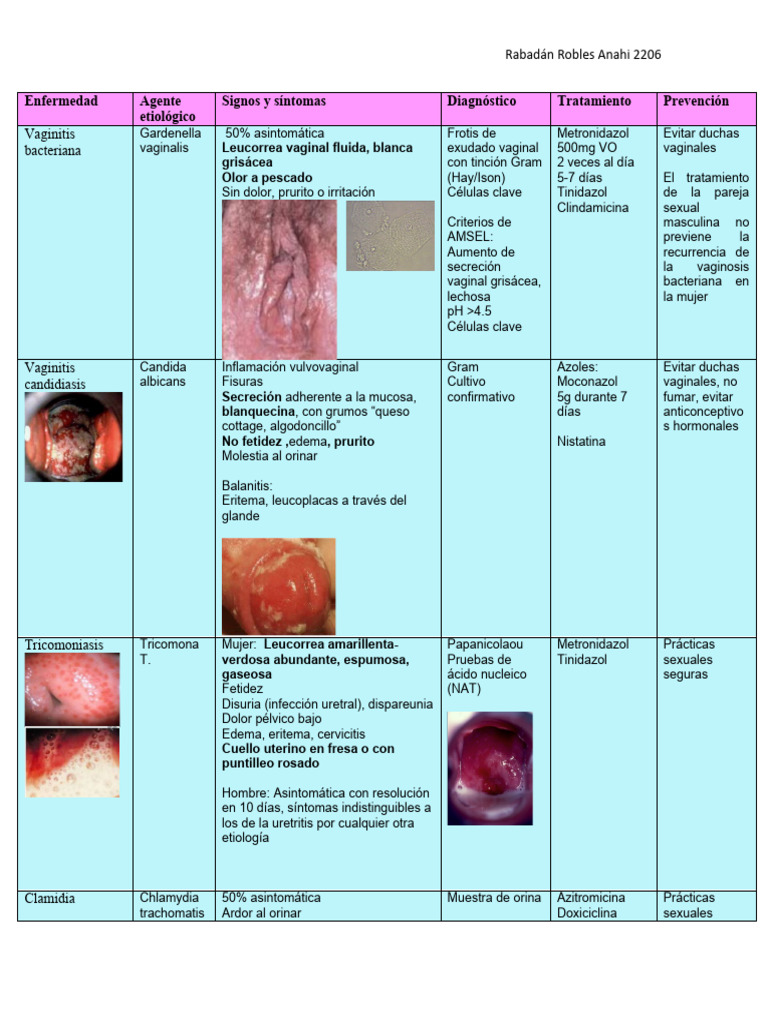 Leucorrea Vaginal Fluida, Blanca Grisácea Olor A Pescado | PDF