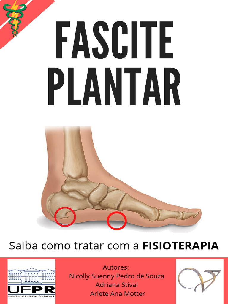Tratamento Fisioterapêutico da Fascite Plantar | PDF | Anatomia dos membros inferiores | Sistema ...