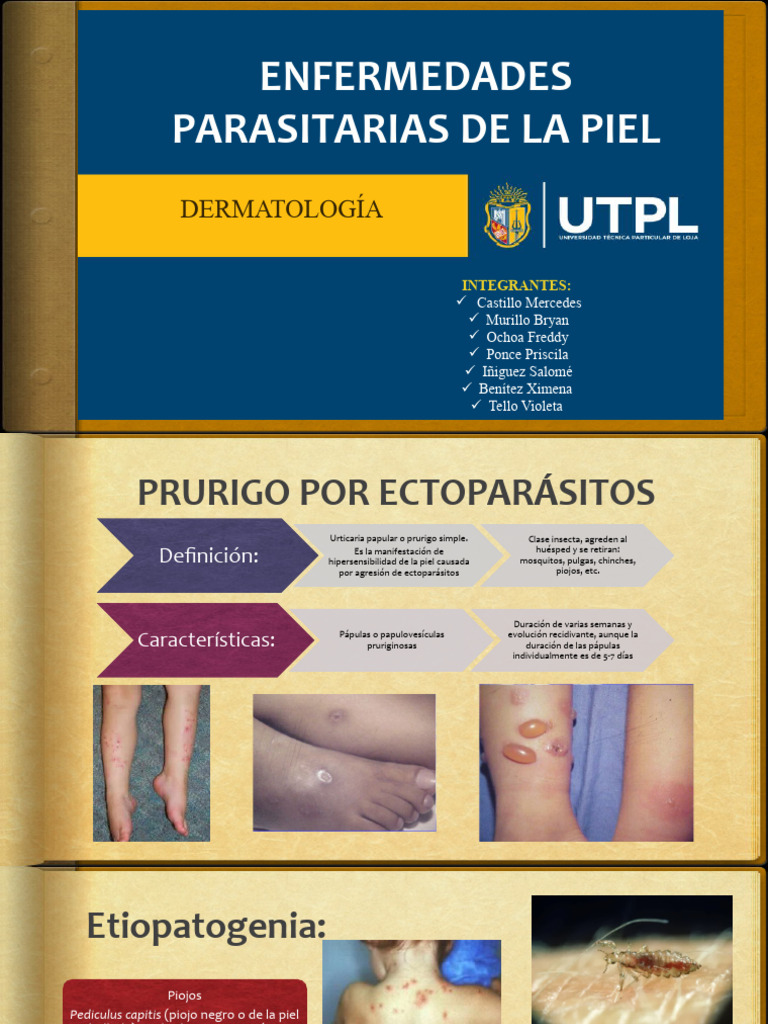 Enfermedades Parasitarias Presentacion | PDF