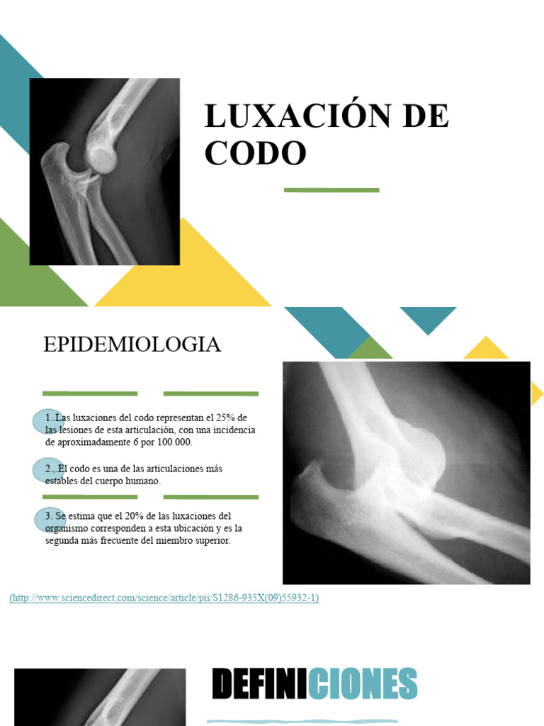 Luxación de Codo | PDF | Codo | Sistema musculoesquelético
