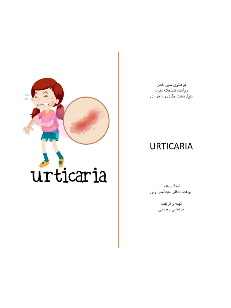 Urticaria PDF | PDF