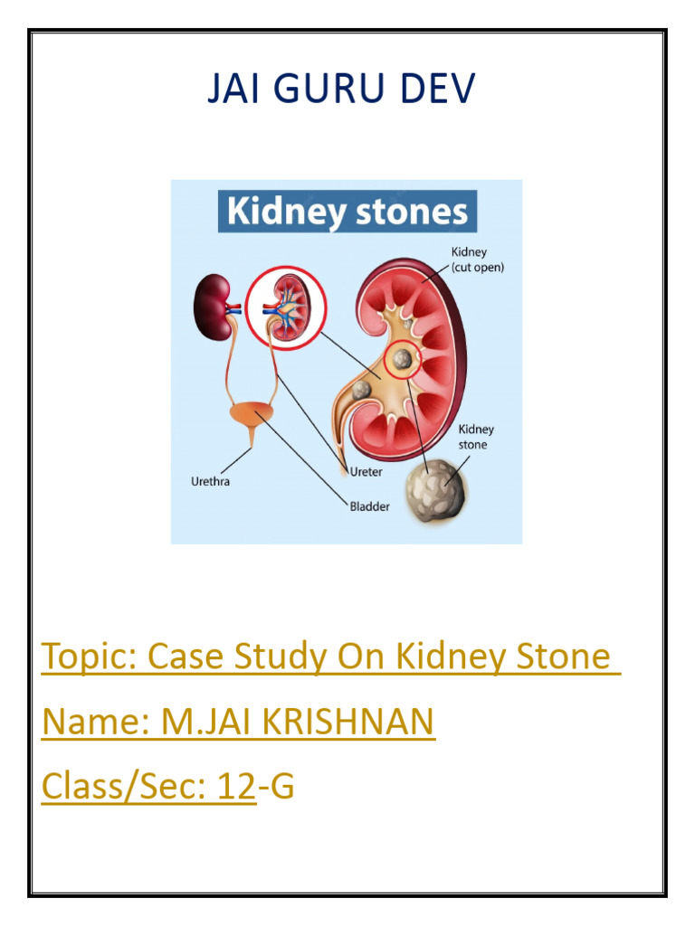 Case Study On Kidney Stone | PDF | Urine | Kidney